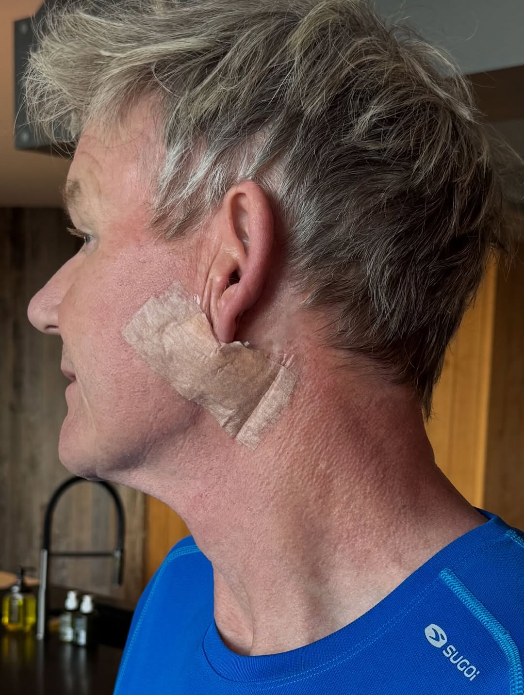 Gordon Ramsay undergoes treatment for skin cancer, reminds others to ...