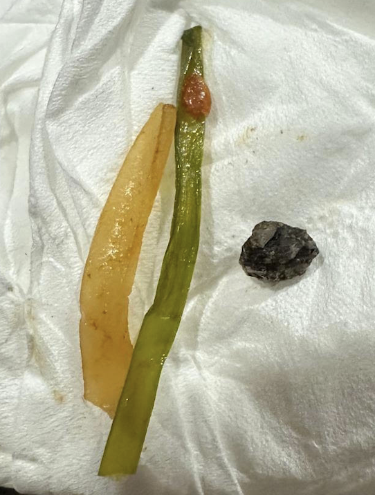 Customer allegedly cracked his tooth on foreign object while eating ...