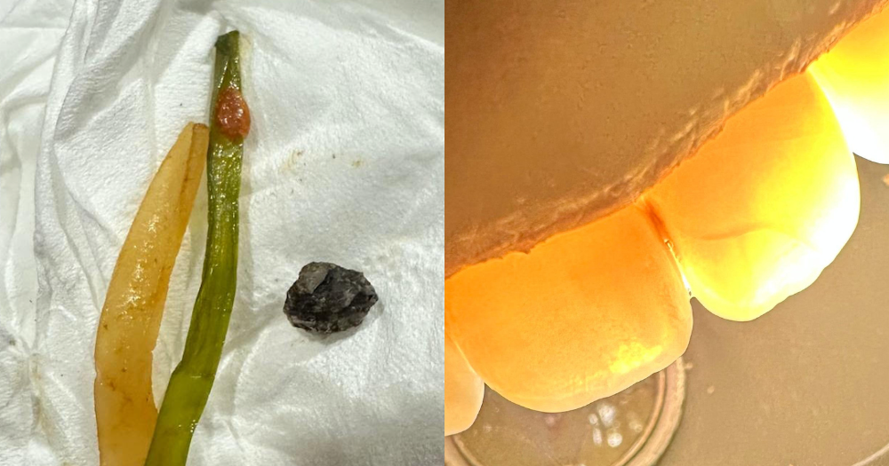 Customer allegedly cracked his tooth on foreign object while eating ...